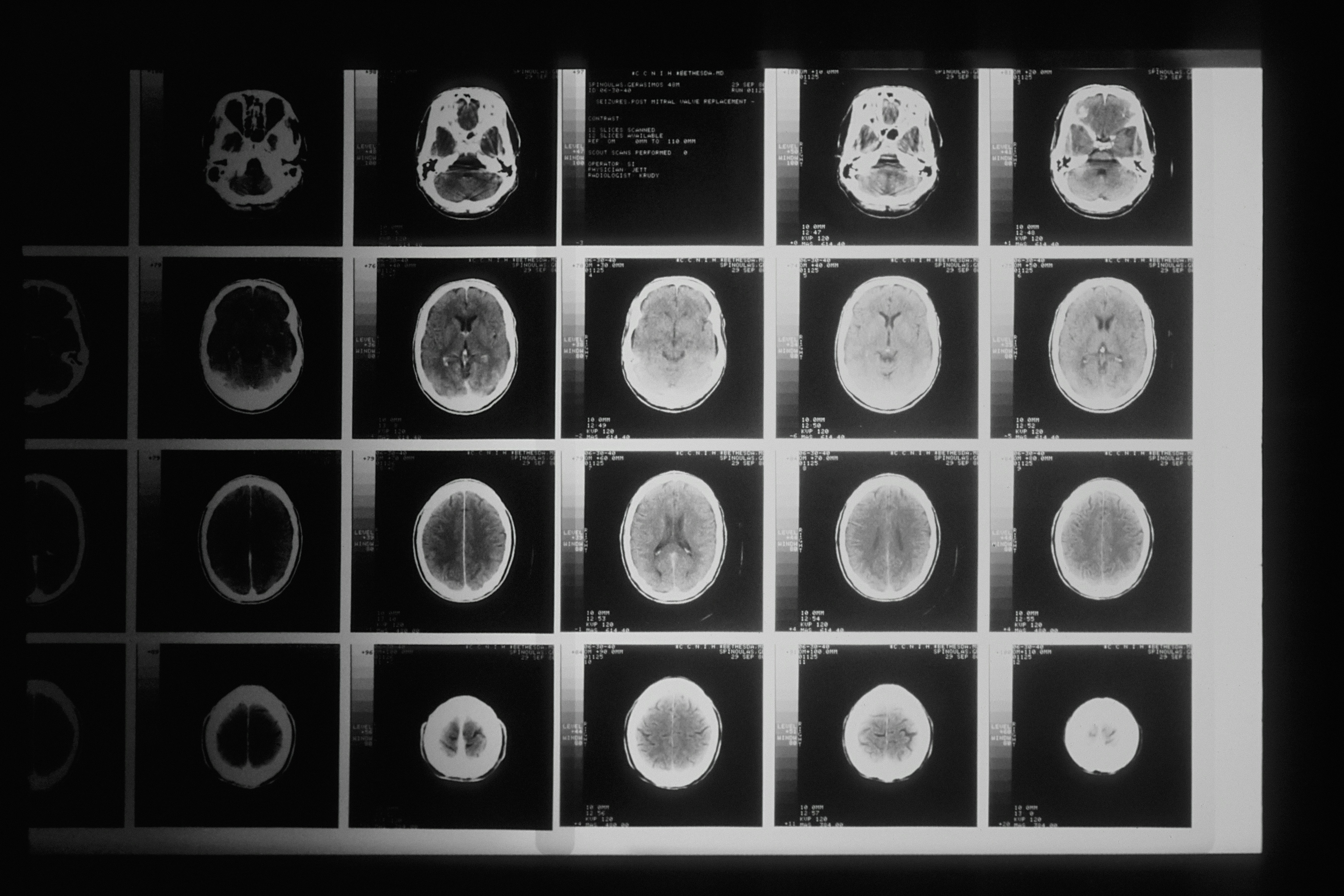 Managing Right-Brained vs Left-Brained Employees – Dave Edwards Media